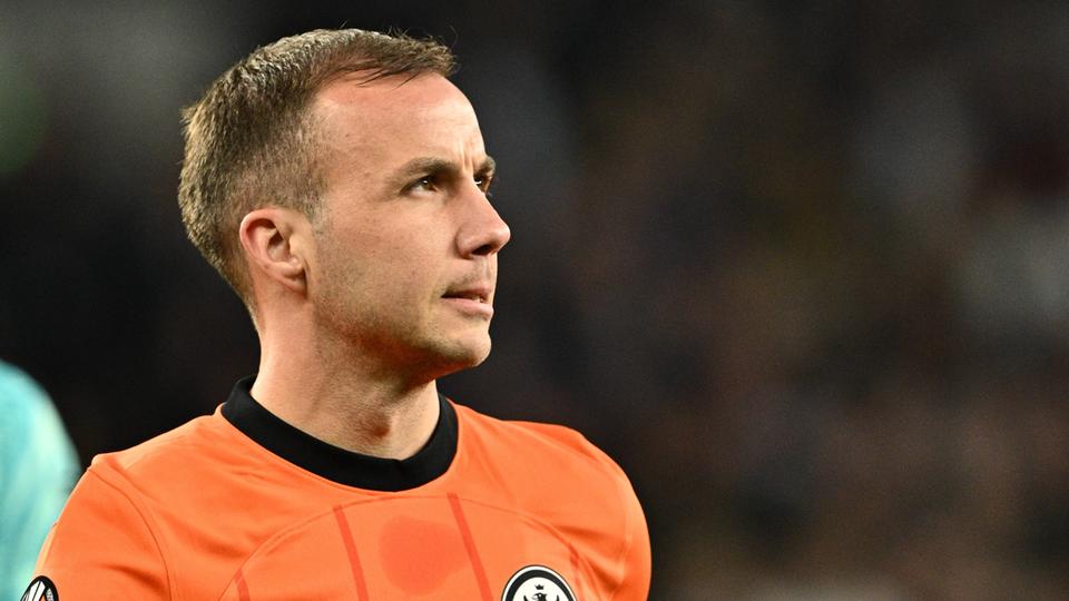 Mario Götze: Deshalb steht er zu seiner Haartransplantation | brisant.de